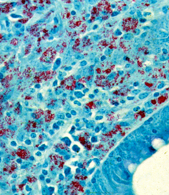 Johne’s disease: A to Z – Johne's Information Center – UW–Madison