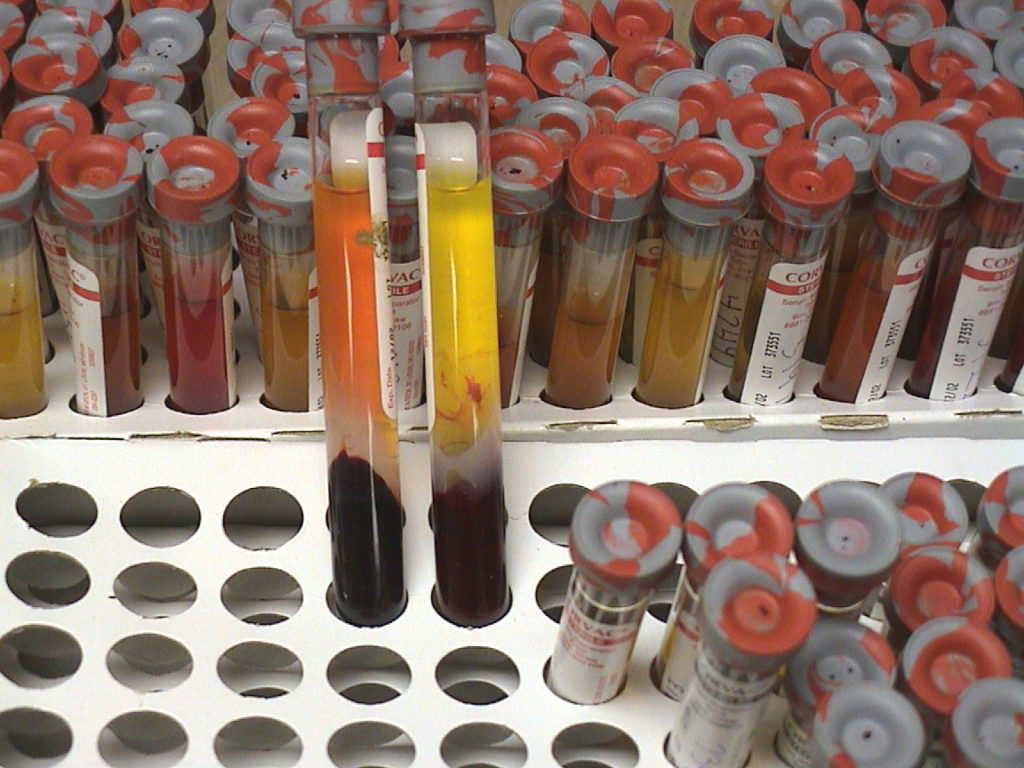 Diagnosis – Johne's Information Center – UW–Madison