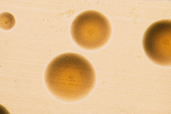 MAP bacteria and cultures – Johne's Information Center – UW–Madison