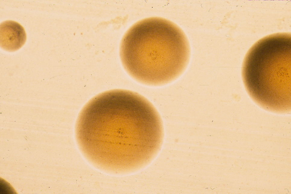 MAP bacteria and cultures – Johne's Information Center – UW–Madison