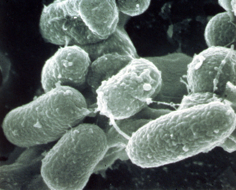 MAP bacteria and cultures – Johne's Information Center – UW–Madison