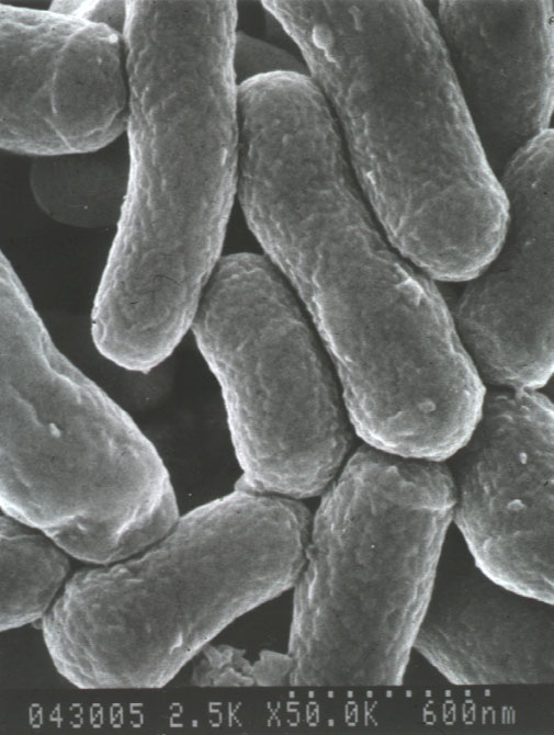 MAP bacteria and cultures – Johne's Information Center – UW–Madison